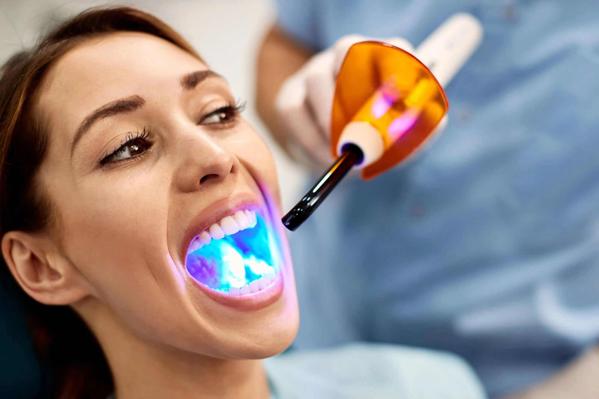Why Your Friends Whitening Results Look Different Factors That Affect